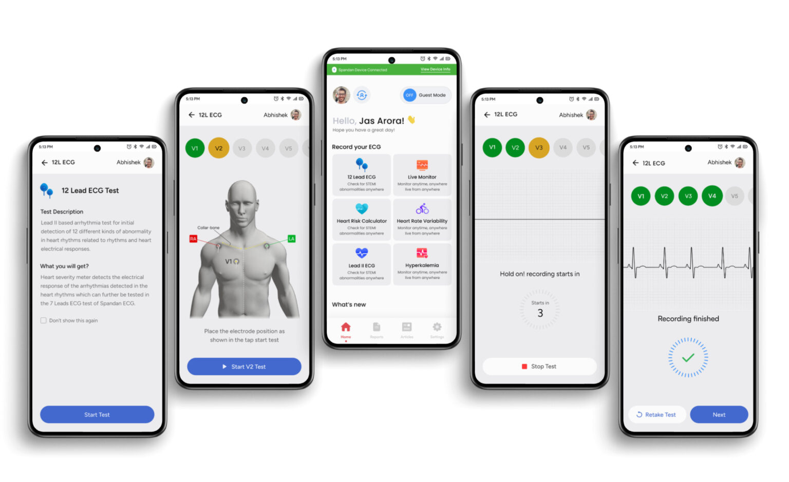 Sunfox Spandan Neo | Portable ECG device for home & Clinic | Detect ...